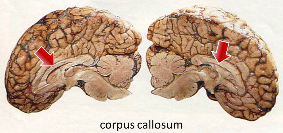 เบื่อหมอ: Alien Hand Syndrome สุดยอดโรคแปลก กับอาการควบคุมมือตัวเองไม่ได้