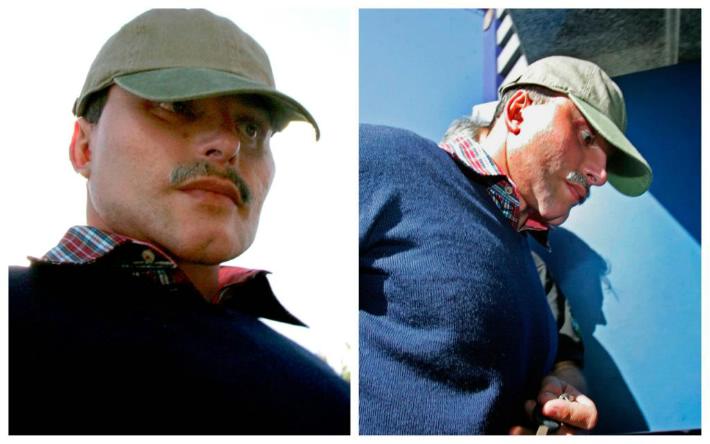 Revela "El Chupeta" por qué se sometió a tantas cirugías | Entre Veredas