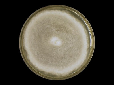 Fun With Microbiology (What's Buggin' You?): Absidia corymbifera ...