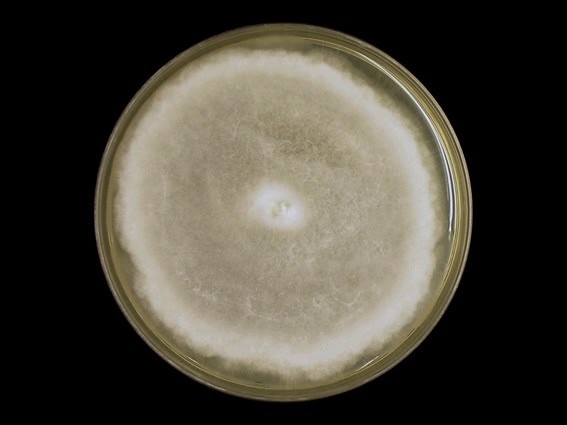 Fun With Microbiology (What's Buggin' You?): Absidia corymbifera ...