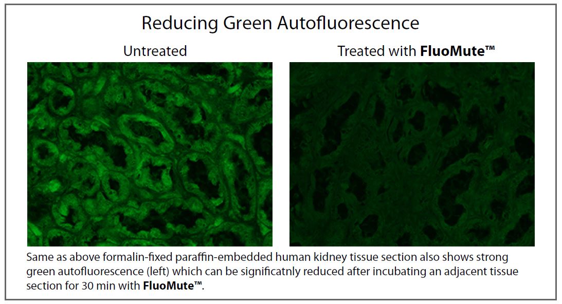 Neuromics: Got Autofluorescence?