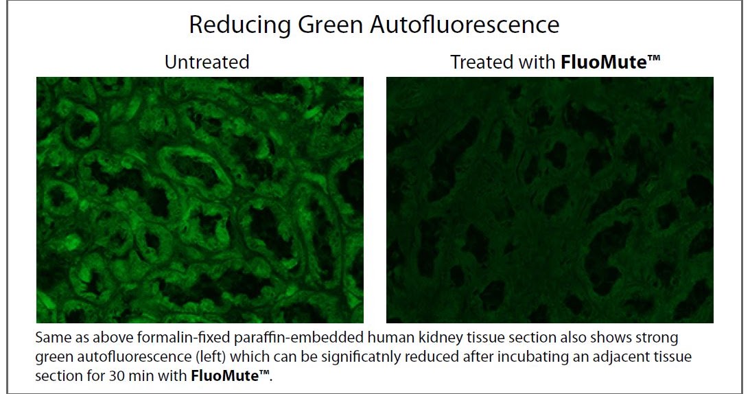 Neuromics: Got Autofluorescence?