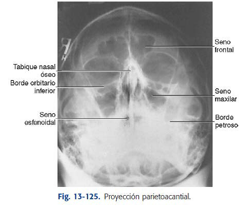 PRODUCCION Y TRATAMIENTO DE IMAGENES DIAGNOSTICAS: CAPITULO HUESOS ...