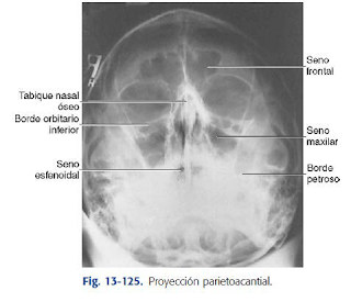PRODUCCION Y TRATAMIENTO DE IMAGENES DIAGNOSTICAS: CAPITULO HUESOS ...