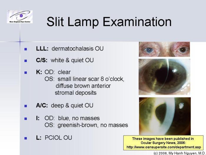 my eyes is the mirror of my heart: Eye examination