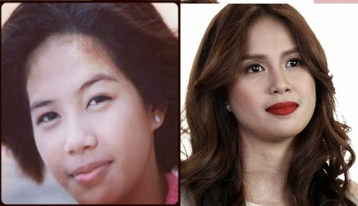 CelebrityTransformations: Shocking Before and After Photos of ...