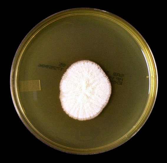 Fun With Microbiology (What's Buggin' You?): Sarocladium kiliense