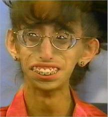 Leitura é conhecimento!: Fotos das pessoas mais feias do mundo