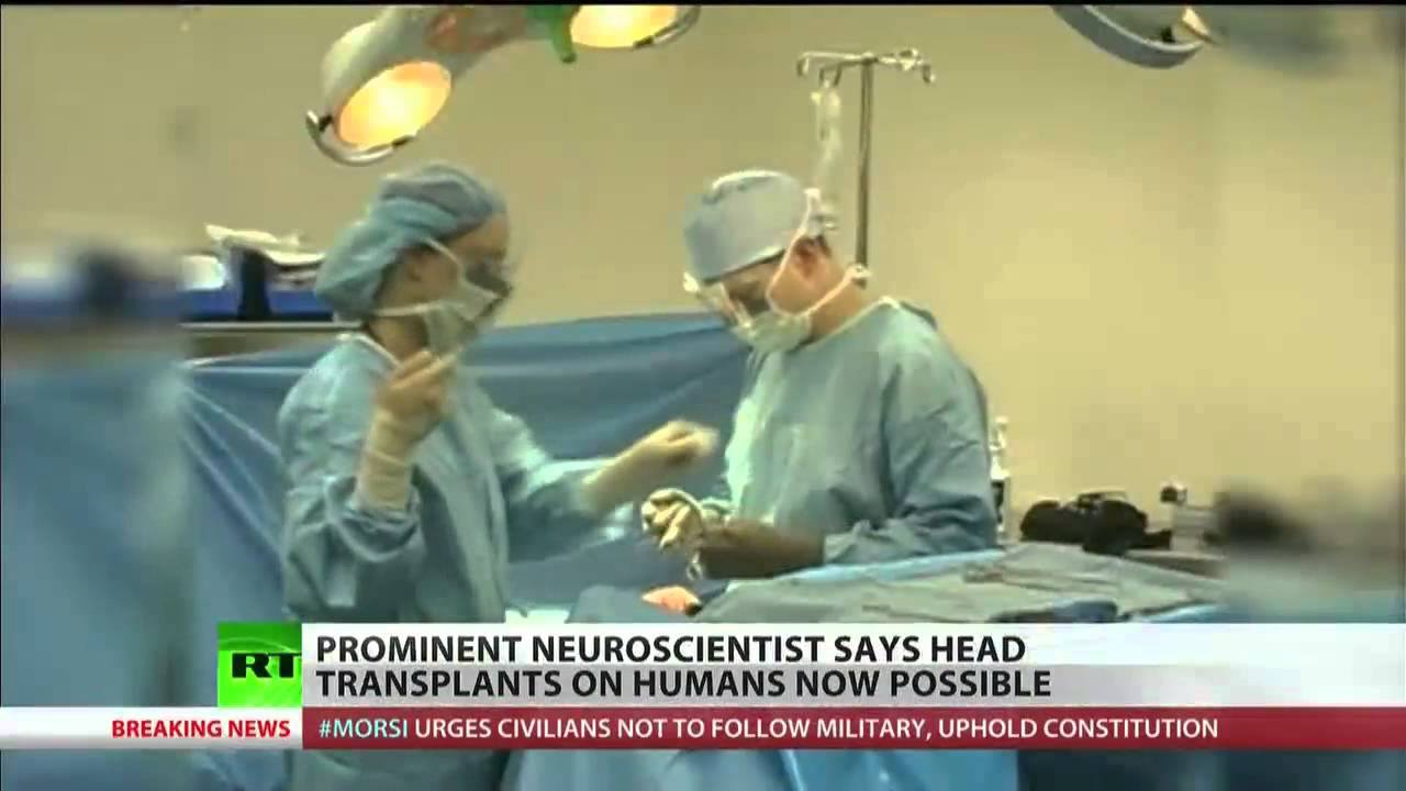 VARUN: How to Perform A Human Head Transplant