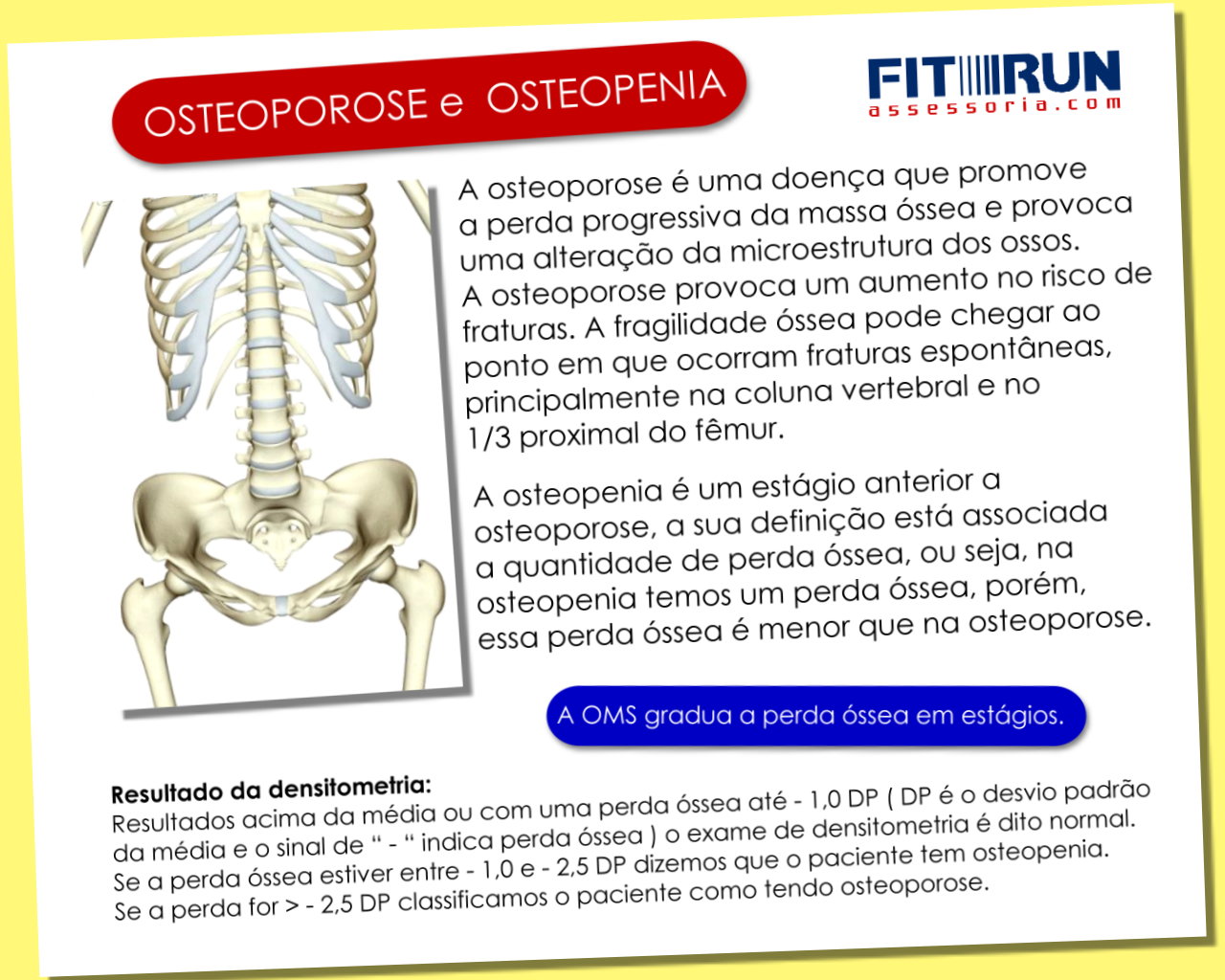 LUCIANA MAGALHÃES PERSONAL TRAINER: Osteoporose e osteopenia