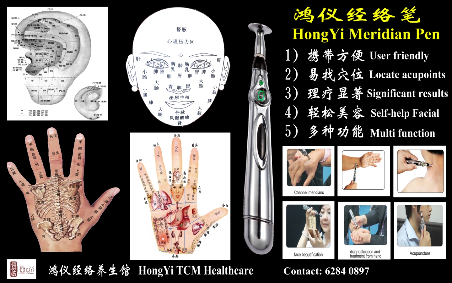 HongYi TCM Healthcare Pte Ltd: HongYi Meridian Pen