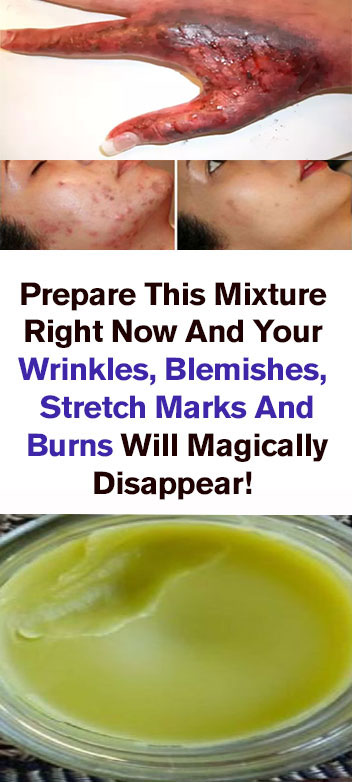 Prepare This Mixture Right Now And Your Wrinkles, Blemishes, Stretch ...