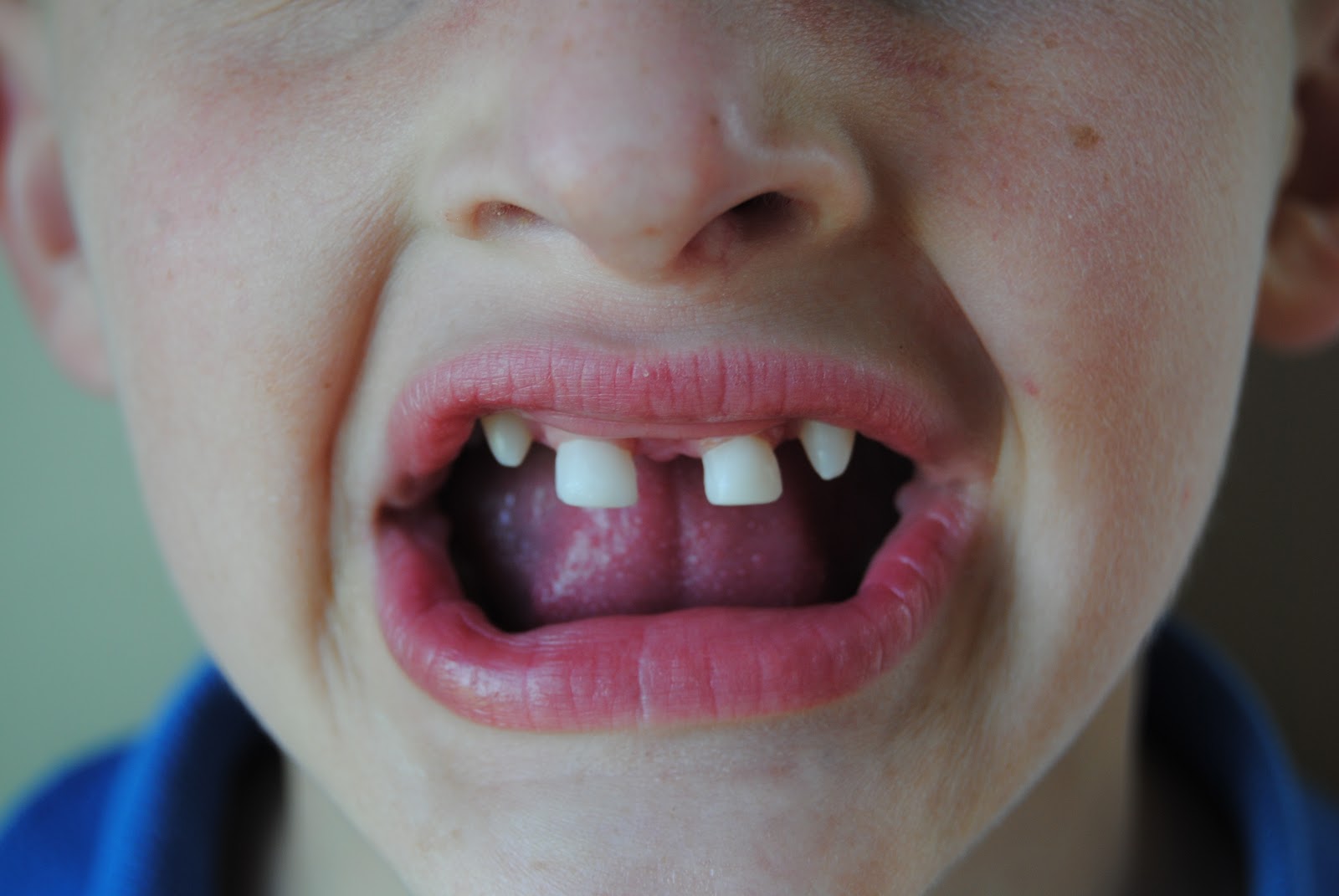 One Big Joyful Family: Teeth