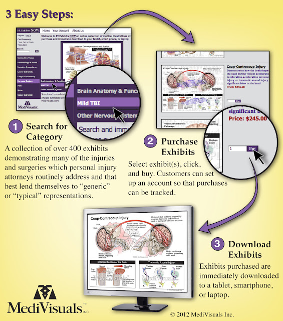The Medical Legal Exhibit Expert Blog: Introducing . . . P.I. Exhibits NOW