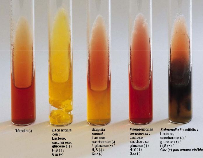 TRIPLE SUGAR IRON (TSI AGAR) | ÜÇLÜ ŞEKER TESTİ - Microbiology Lab Notes