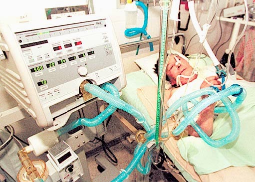 Generalidades del Cuidado crítico