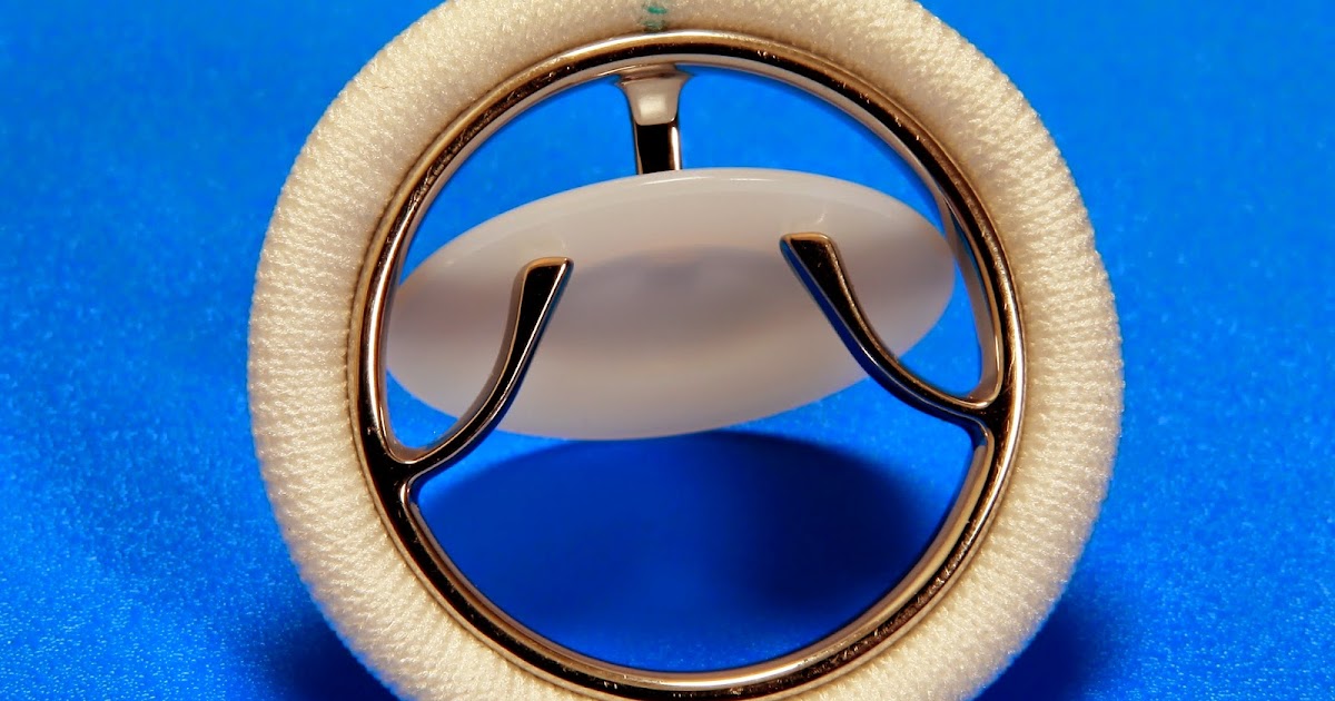 Global Healthcare: The TTK Chitra Heart Valve: A High Quality ...