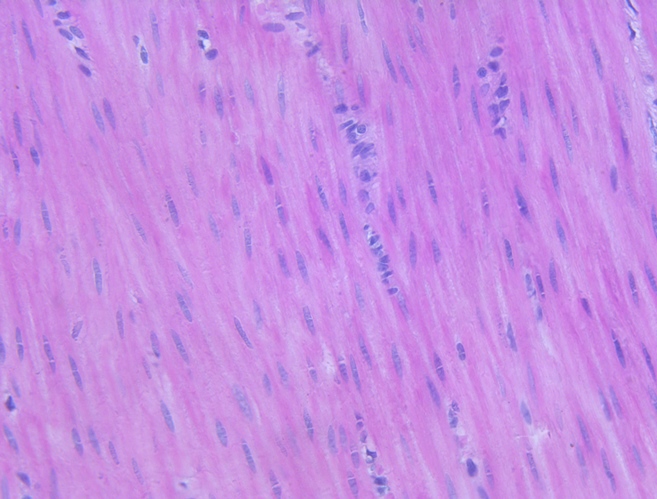 Manual interactivo de morfología celular: Morfología de células fusiformes