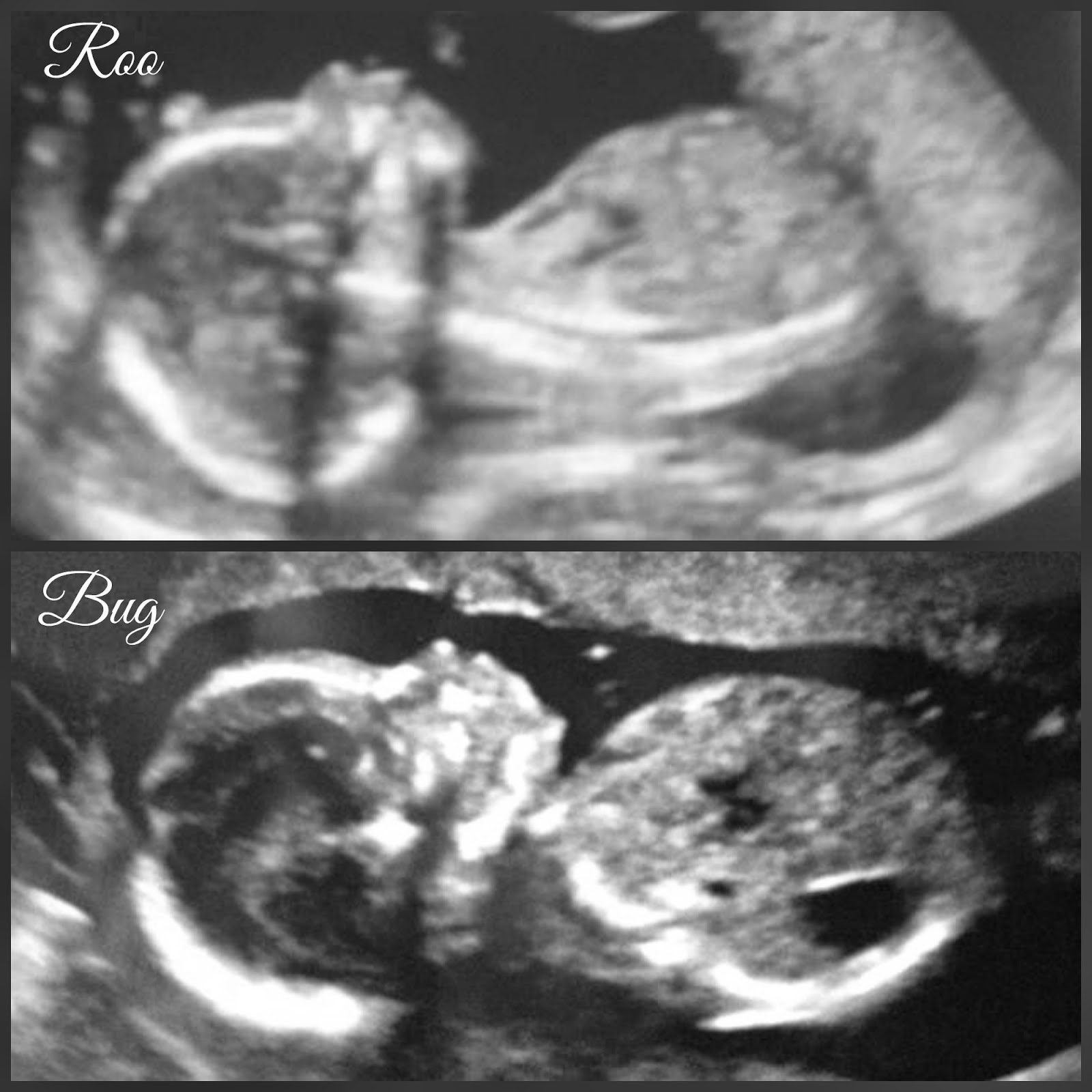 19 weeks - Ultrasound & Gender Reveal TOMORROW!!
