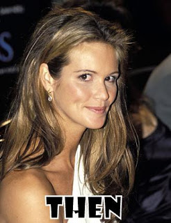 Elle Macpherson Plastic Surgery Before and After Botox and Breast ...