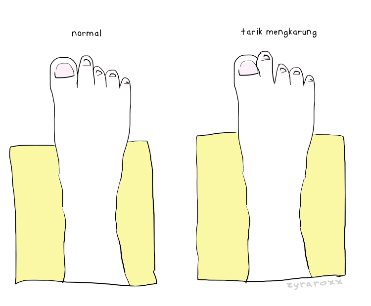 Mengkarung Dan Semut | Zyraroxx