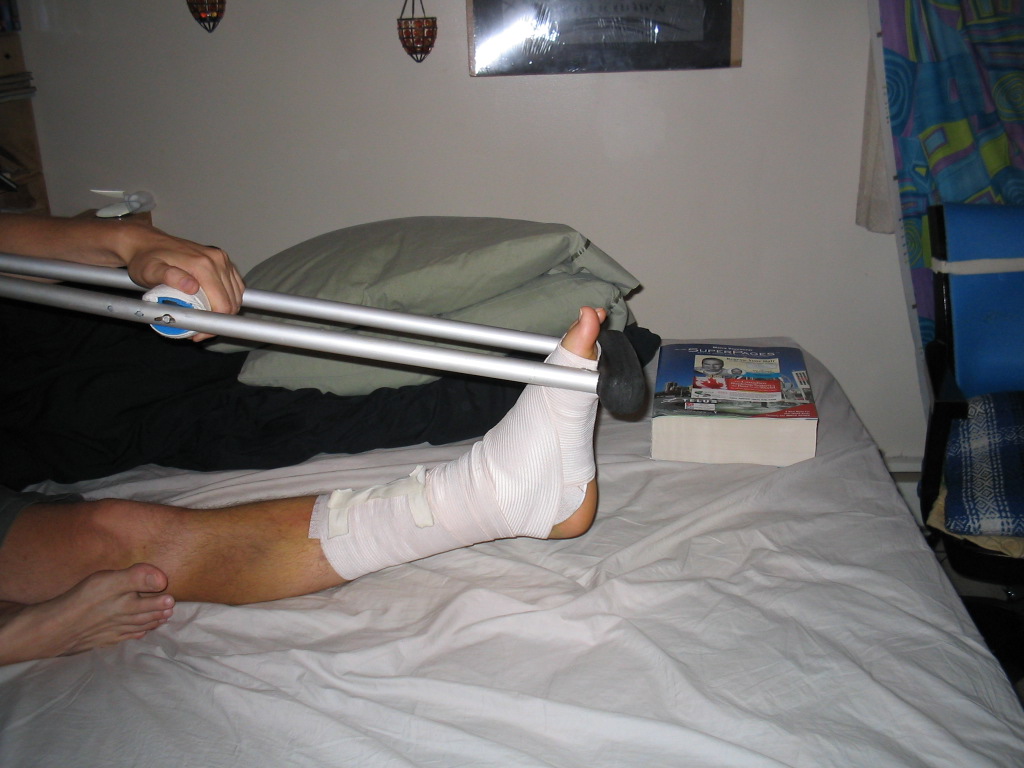 1wuz's chalk board.: Gimp Foot