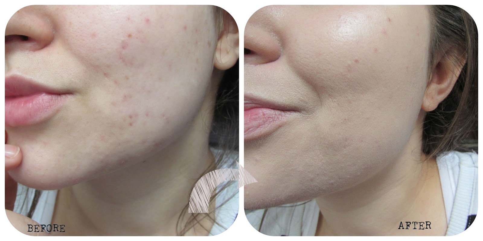 Ce BB Cream folosesc pentru tenul gras? - Blog CuLore