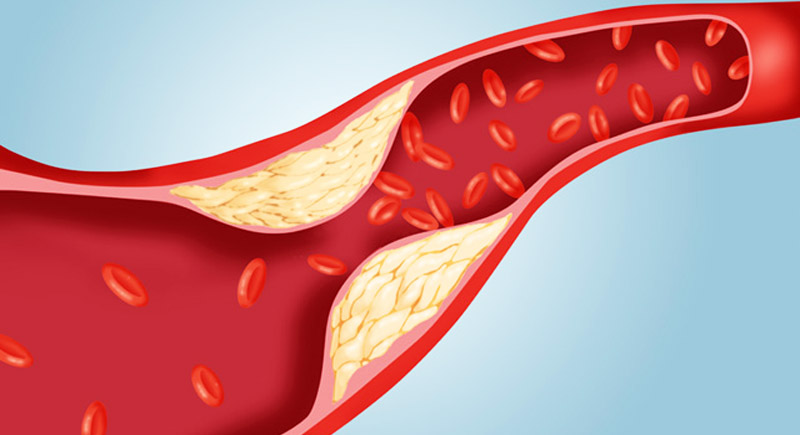 EL COLESTEROL - CON TU VIDA EN SALUD