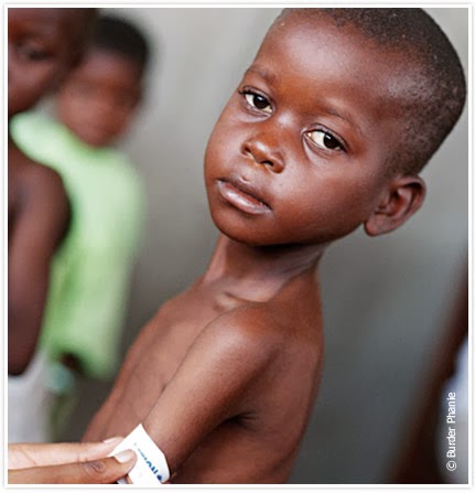 La Desnutrición, concepto y tipos ~ El Médico Contesta