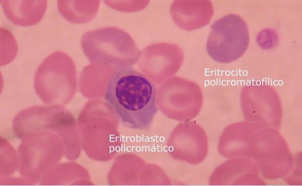 Fichero de Hematología: Eritroblasto Policromático (Normoblasto ...