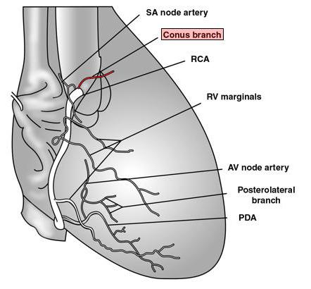 The Pump and the Tubes: The Third Coronary Artery? (the conus artery)