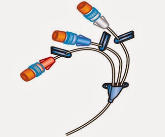 Administering Medication through a Central Venous Access Device ~ Nursing