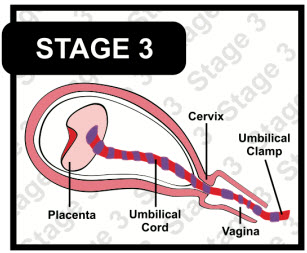 KALA 1,2,3,4 DALAM PERSALINAN | Bidanshop