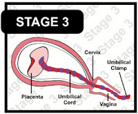KALA 1,2,3,4 DALAM PERSALINAN | Bidanshop