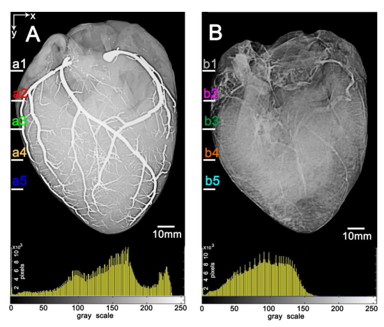 Tecnicos Radiologos: Metal líquido usado como contraste radiológico
