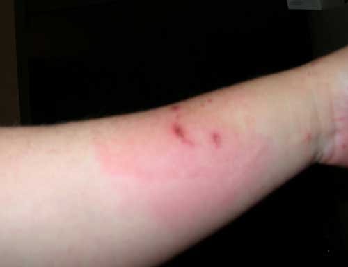 Blog About Cats: Picture of Cat Scratch Fever