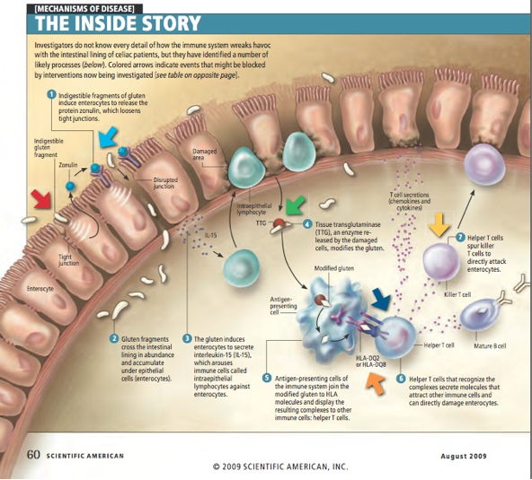 Functional Wisdom...healthy updates from Dr. Jill!: Zonulin & Leaky Gut ...
