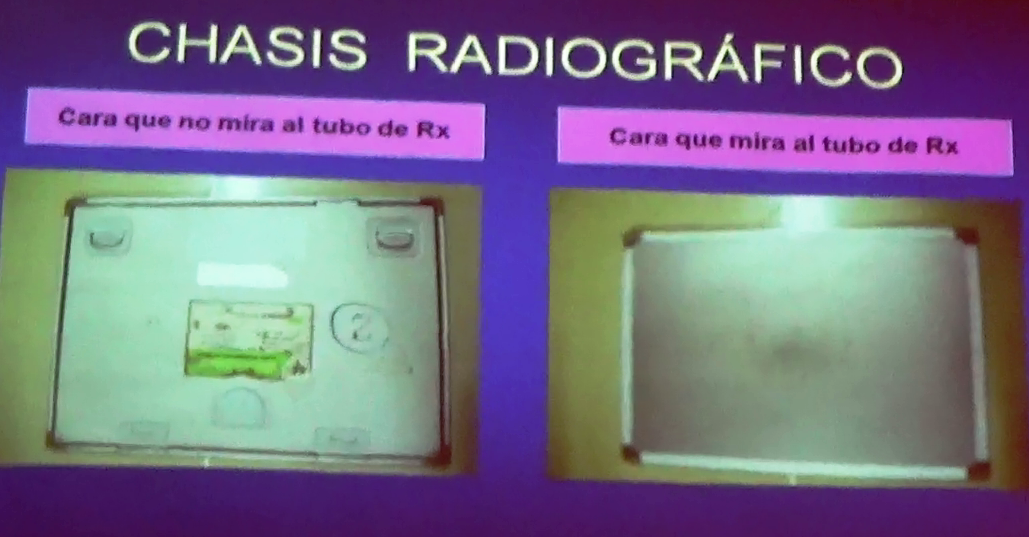 RADIODIAGNOSTICO: SEGUNDA CLASE DE RADIODIAGNOSTICO