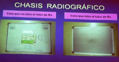 RADIODIAGNOSTICO: SEGUNDA CLASE DE RADIODIAGNOSTICO