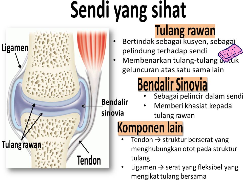 Sakit Sendi : Rawat Dengan Set Sendi Shaklee