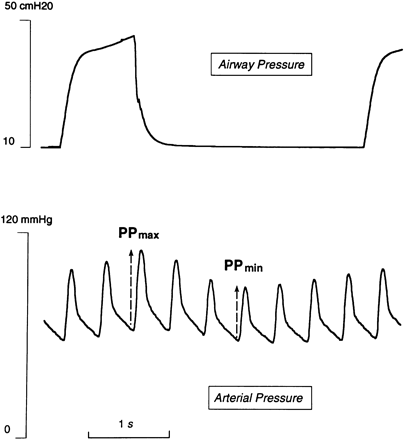 Paciente Grave: O ΔPP tem lugar na prática diária?