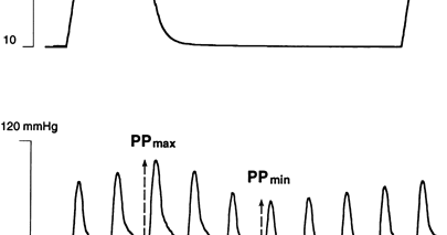 Paciente Grave: O ΔPP tem lugar na prática diária?