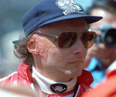 Bespectacled Birthdays: Niki Lauda, c.1977