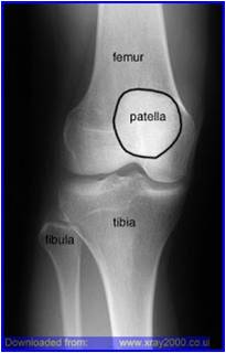 Proyeksi pemeriksaan Genu | Aditya Radiografer