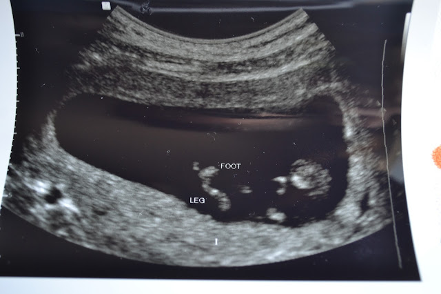 The Baker Bustle: Guess Whaaaaaaaaat!!!