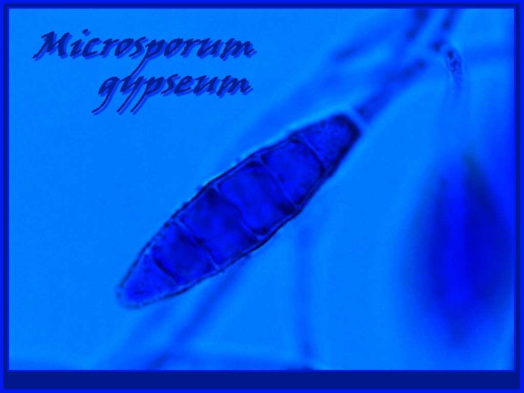 Fun With Microbiology (What's Buggin' You?): Microsporum gypseum