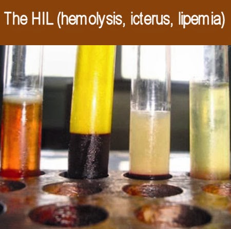 Medical Laboratory and Biomedical Science: Is Sample Quality in the Eye ...