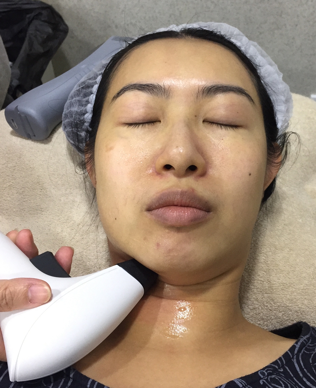 Wintyb 的瘋狂生活: Viora Reaction CORE 提升面型輪廓療程