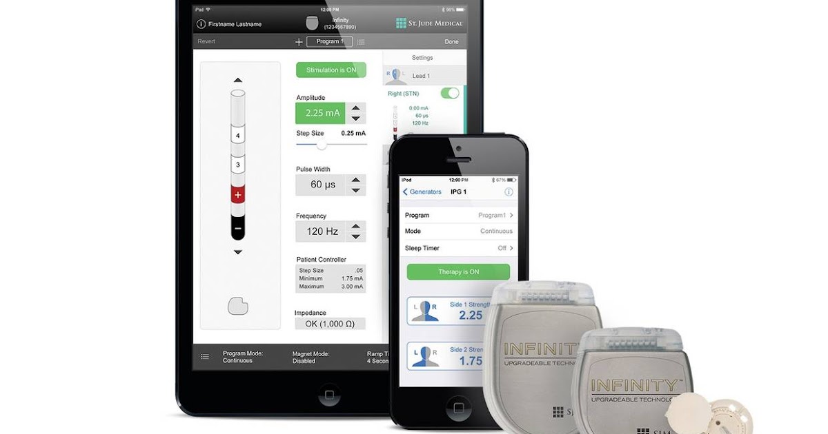 Our Parkinson's Place: Parkinson’s Therapy Gets Fresh Look From Device ...