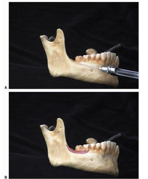 Dentistry lectures for MFDS/MJDF/NBDE/ORE: Anatomical Considerations in ...